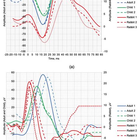 Wavelet Scalograms Scotopic 20 Erg Response Waveforms In Healthy Human