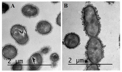 Pathogens Special Issue Streptococcus Suis