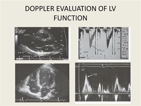 Evaluate Lv Function Paul Smith
