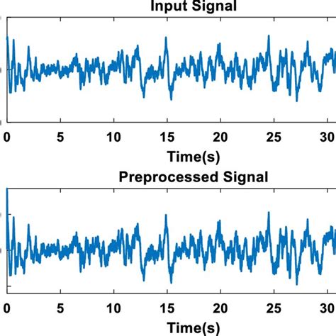 Non Eois Detection Using Stockwell Entropy Based On Hilbert Transform A