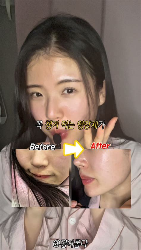 경이롭다 뷰티 • 여드름 • 관리 제품제공 다들 영양제 몇 개 먹어 글루타치온 은 처음인데 달달하니 맛있더라구요