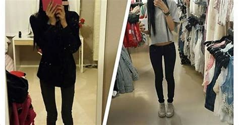 Anorexia Recovery 84lbs To 110lbs Imgur