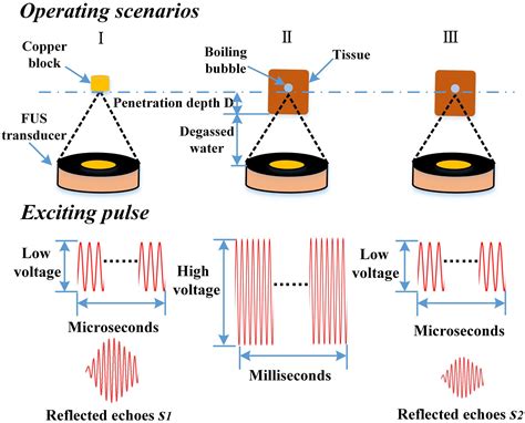 In Situ Measurement Of Acoustic Attenuation For Focused Ultrasound Ablation Surgery Using A