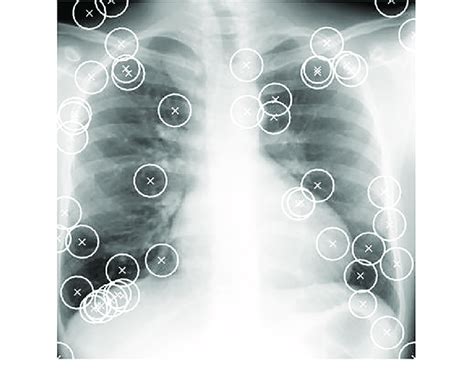 Salient Image Regions Key Points Detected By The Difference Of Download Scientific Diagram