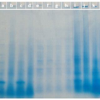 SDS PAGE Results Sample From The Left To Right Lane Std Marker Lane