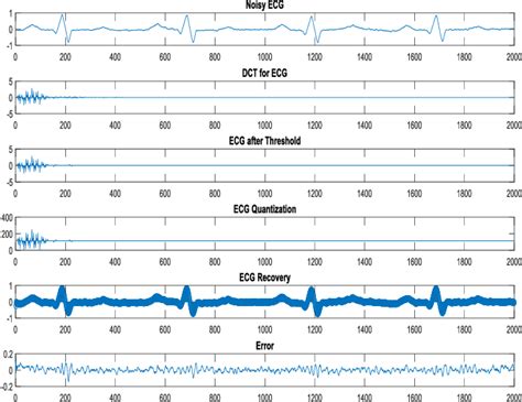 Figure 1 From Simulation For Design The Compressed Ecg Signal