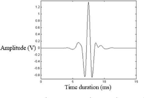 Figure 23 From Fetal Electrocardiogram Detection And Analysis From