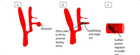 Graphical Representation Of Scaffolding Technique A Representative Download Scientific