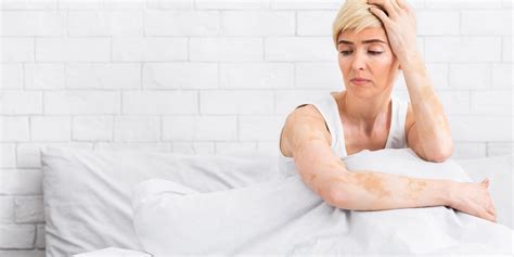 Атопичен дерматит при възрастни Какво помага Svr