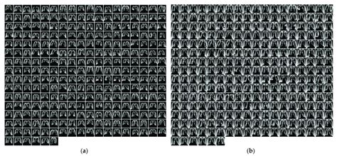a segmented jsrt images b segmented and cropped jsrt images jsrt