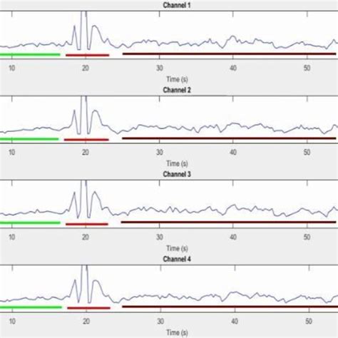 2 Result Of Participants Eeg Recording Download Scientific Diagram