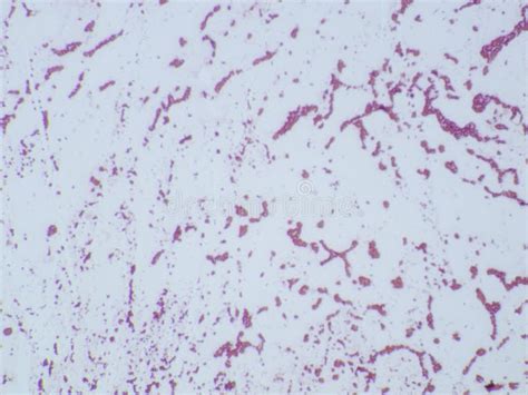 Enterococcus Faecalisi Stock Image Image Of Acetone 351329375