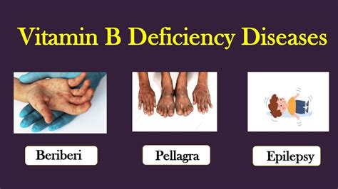 Vitamin B Deficiency Oily Skin At Caitlyn Buvelot Blog