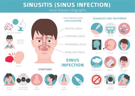 Sinus Infection Sinusitis Causes Symptoms And Treatment