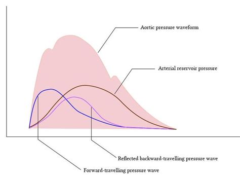 Normal Arterial Line Waveforms Deranged Physiology Arterial Line Mean Arterial Pressure