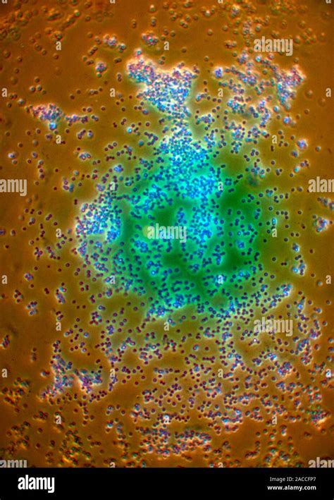 Phase Contrast Light Micrograph Of A Group Of Staphylococcus Aureus A Type Of Non Motile