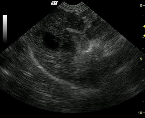 Gall Bladder Mucocele Cholangiohepatitis In A 6 Year Old Mn Cocker