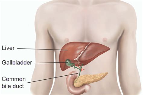 Open Cholecystectomy Lowcost Surgicals