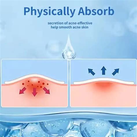 Pimple Patch Rx Value Pack 324 Patches 4 Sizes Sigma Essentials Usa