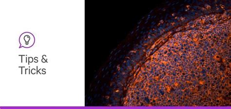 Lectins For Glycobiology Tips And Tricks Vector Laboratories Inc