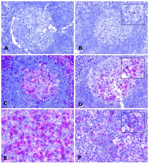 Intra Tissue Linc00892 Localization Using In Situ Hybridization Ish