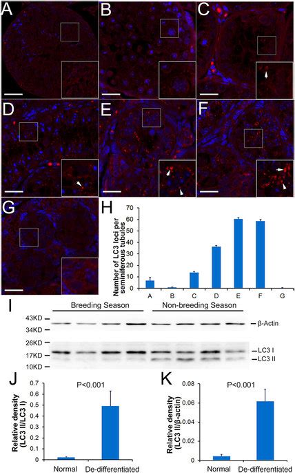 Autophagy Levels In Normal Spermatogenesis And In De Differentiated Download Scientific Diagram