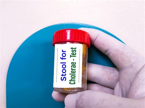 Premium Photo Stool Specimen For Vibrio Choleraepcr And Culture