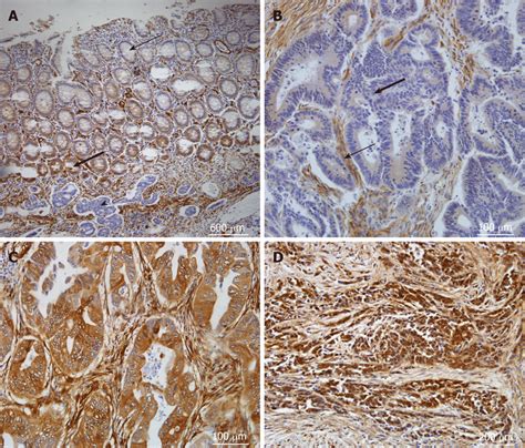 Cnn3 Expression In Formalin Fixed Paraffin Embedded Tissues From