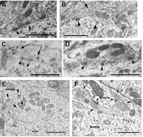 Figure 6 From The Soma And Proximal Dendrites Of Sympathetic