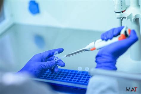 Pediatric Aml Trial Reveals Promising Outcomes In Relapsed Cases