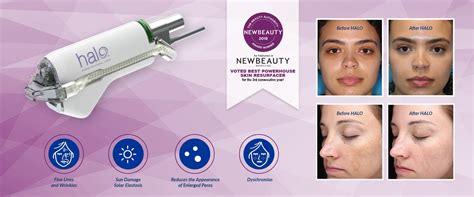 Sciton Halo Laser Aesthetic Laser Treatments — Exclusive Med Aesthetics