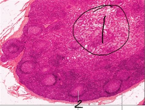 Lab Ch 16 Lymphatic System Labeling Models Slides Flashcards Quizlet