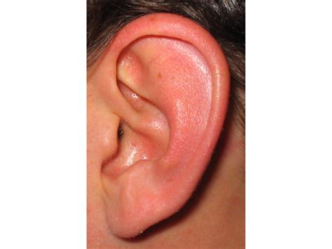 Final Practical 6 Flashcards Quizlet