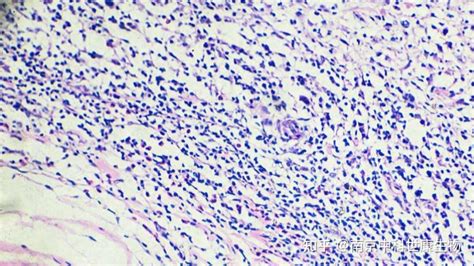 细胞实验——划痕、迁移和侵袭（南京中科世康生物） 知乎