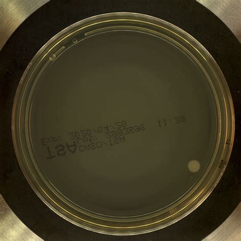 Bacteria Colony Object Detection Instance Segmentation Dataset By Risetta