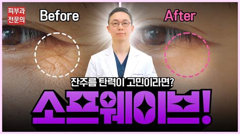 잔주름 탄력에는 써마지보다 소프웨이브🔥핫한 리프팅 소프웨이브의 모든 것 송도휴먼피부과 Youtube