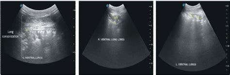 Ultrasonography Of Lung And Pleura Of Feedlot Calves That Developed Brd