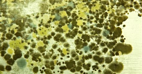 Histamine Intolerance Worse Before Your Period Heres Why And How To Help