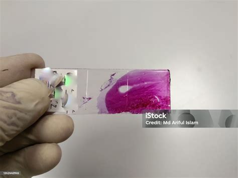 미세 바늘 포부 세포학 의 현미경 유리 슬라이드를 들고 과학자 병리학자에 대한 스톡 사진 및 기타 이미지 병리학자 조직학 현미경 슬라이드 Istock