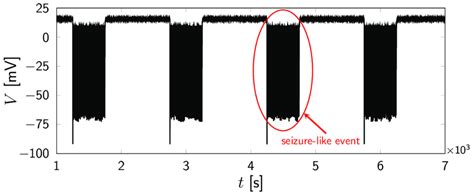 Seizure Like Events With The Memristive Neuromorphic Circuit