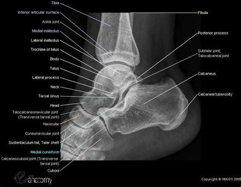 Lateral Ankle Radiology Imaging Medical Anatomy Medical Radiography
