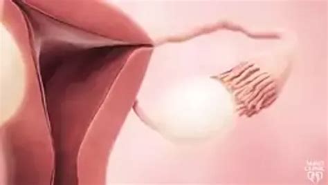 Free Indian Animation Porn Videos Xhamster