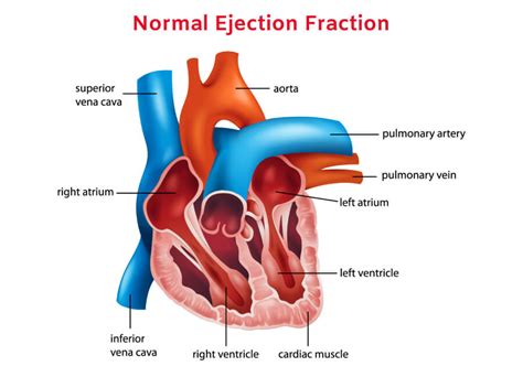 What Is A Normal Ejection Fraction By Age Dr Raghu