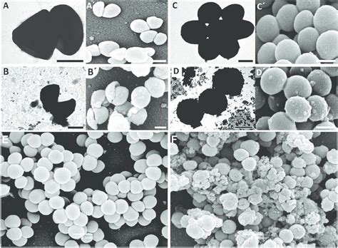 The Bacterial Cell Morphology Of Mrsa Treated With Ceftaroline Tem