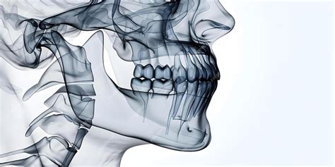 Understanding The Anatomy Of The Temporomandibular Joint Tmj In A