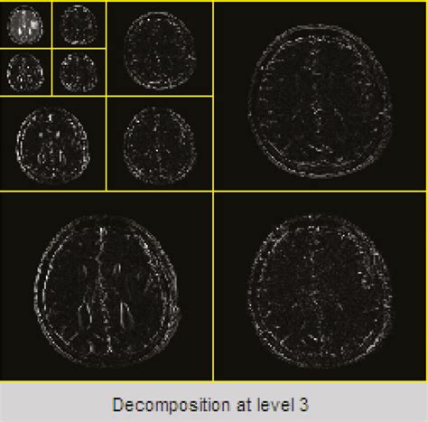 three level wavelet decomposition of mr image download scientific