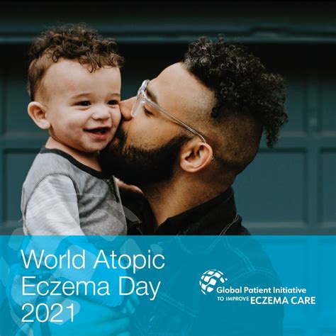 National Eczema Association On Linkedin Eczema Improveeczemacare