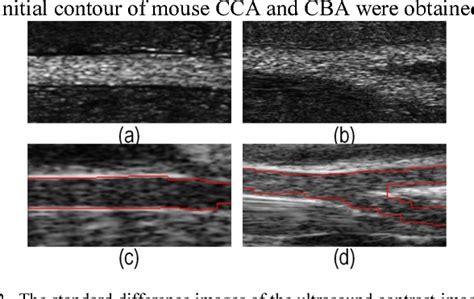 Figure 2 From Ultrasound Contrast Image Segmentation Using A Modified Level Set Method