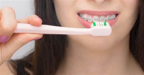 Cómo Cepillarme Los Dientes Con Brackets Centropremoden