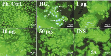 Extract Of Cissus Quadrangularis Extract Cq Induces Extracellular Download Scientific Diagram